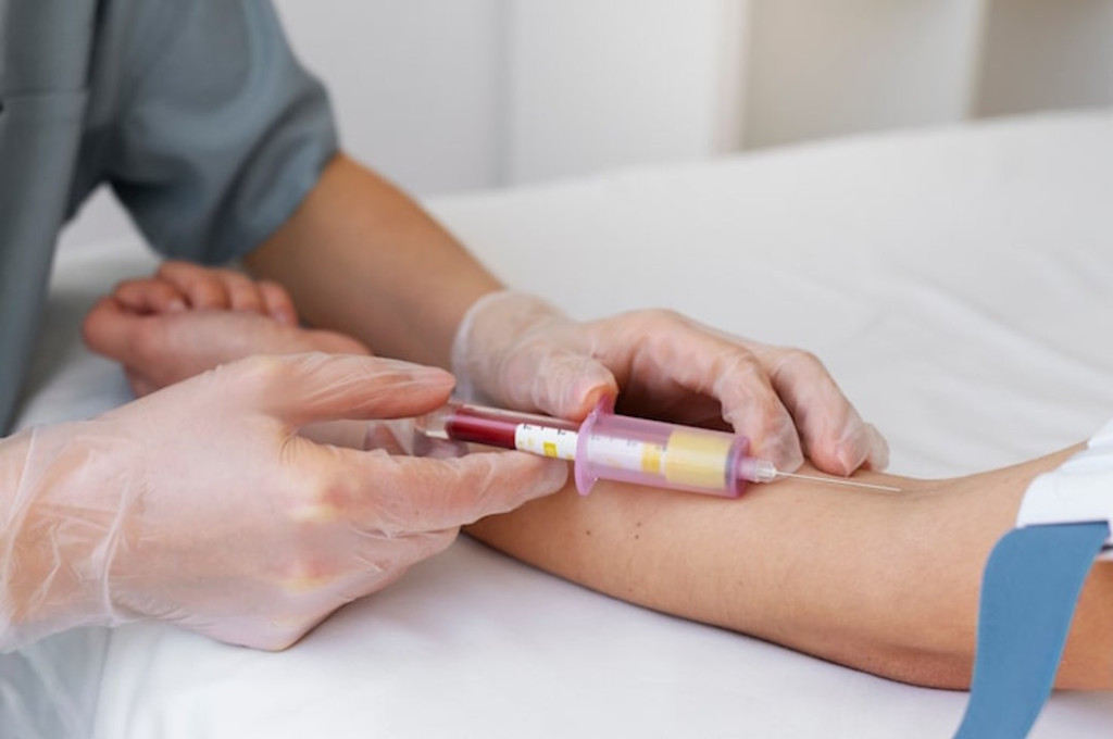 Glycosurie : causes, symptômes et solutions